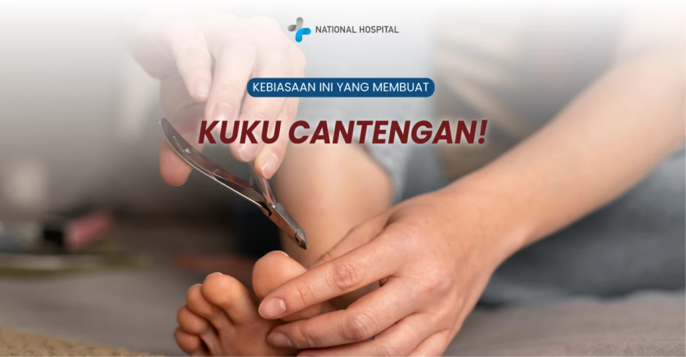 Kebiasaan yang Menyebabkan Kuku Cantengan