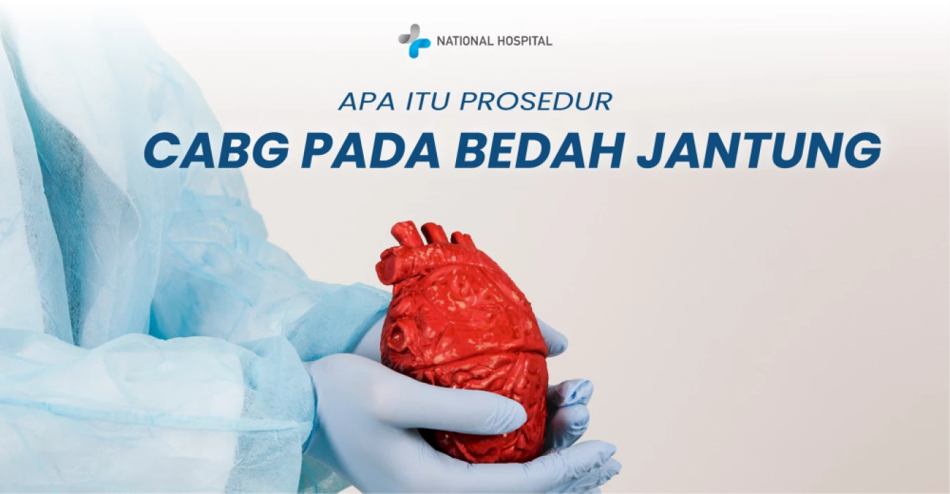 What is CABG Surgery?