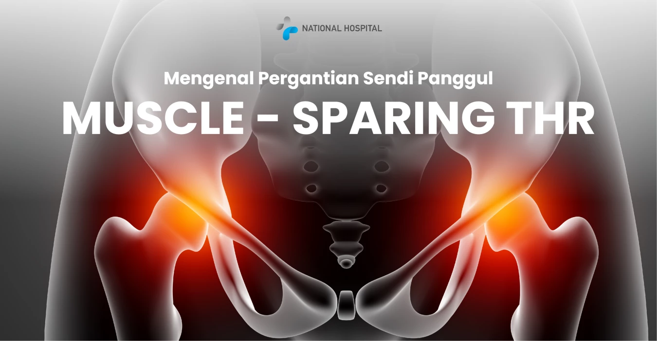 Muscle-Sparing Total Hip Replacement: A Breakthrough in Recovery and ...